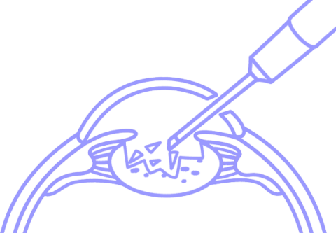 California LASIK & Eye | Modern Vision Solutions in Sacramento, CA